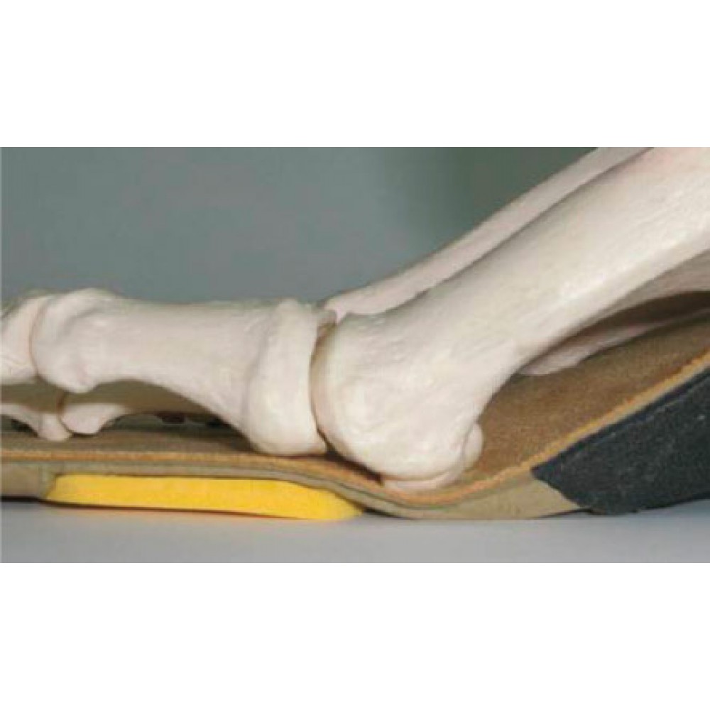 Vasyli Dananberg Full Orthotic - Vasyli Insole - Orthotics & Footcare ...